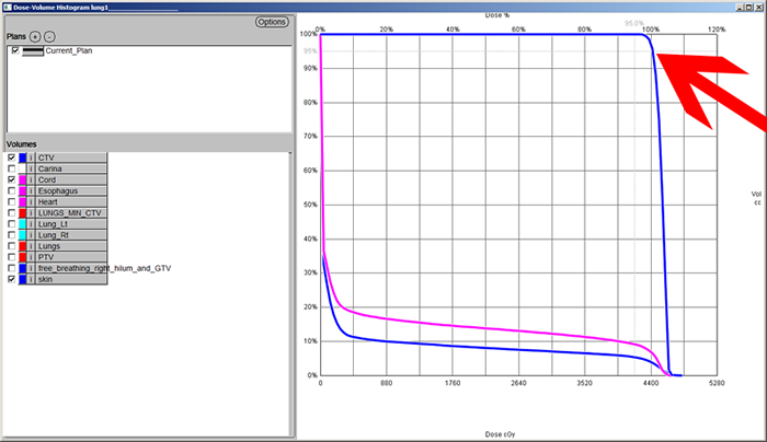 UNC Dosimetry